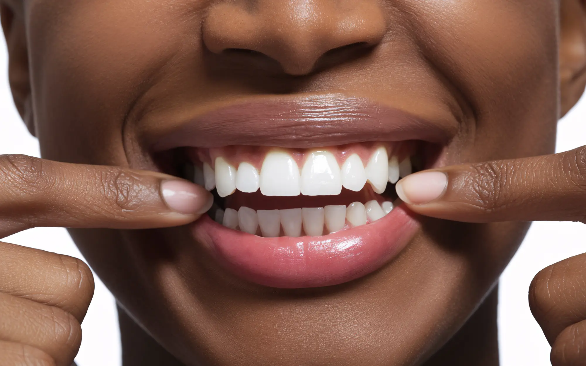 Professional Teeth Whitening in Lawrenceville, GA | Sequoia Smiles